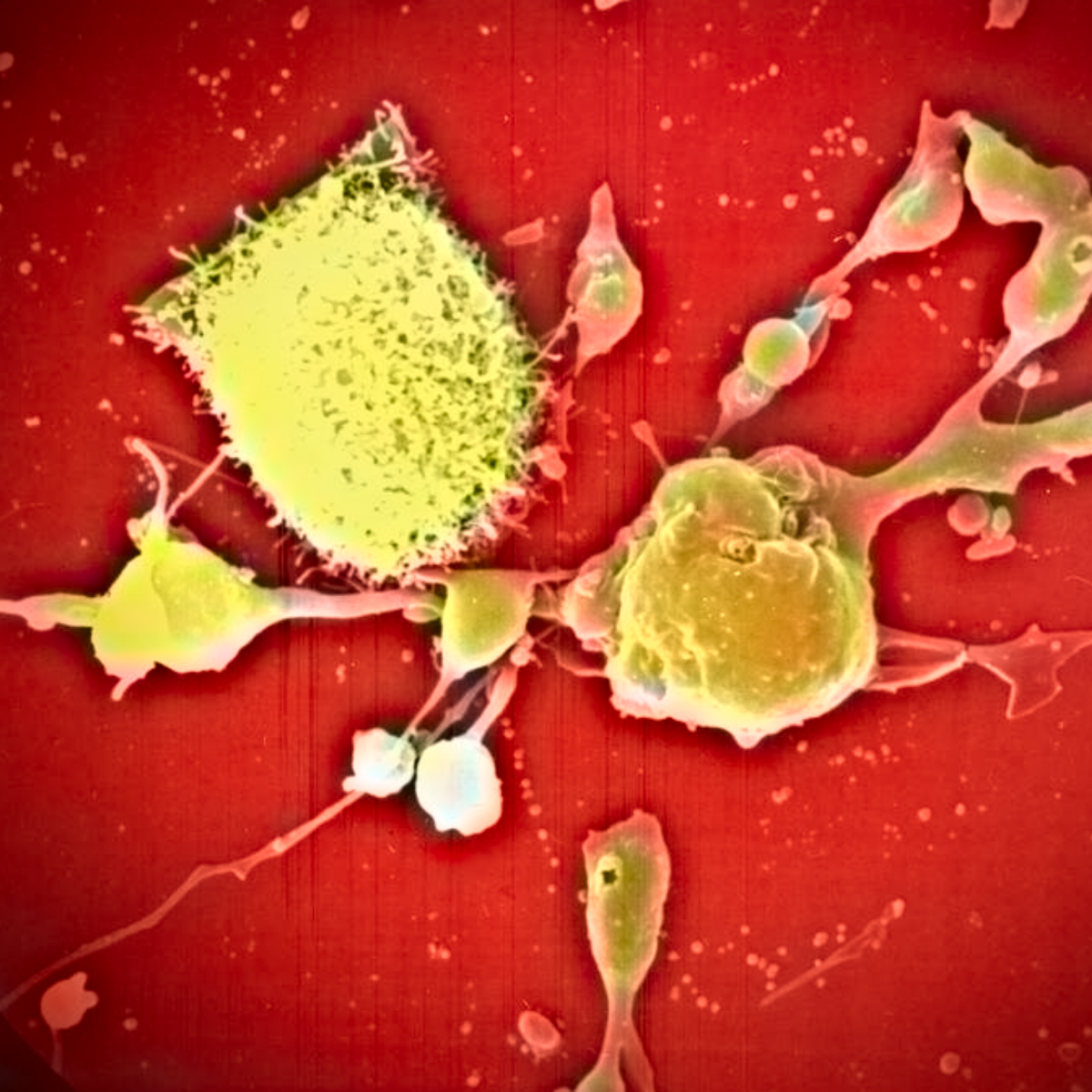 MACR-CANCER.org – HARNESSING RESEARCH DISCOVERIES TO REVOLUTIONIZE ...